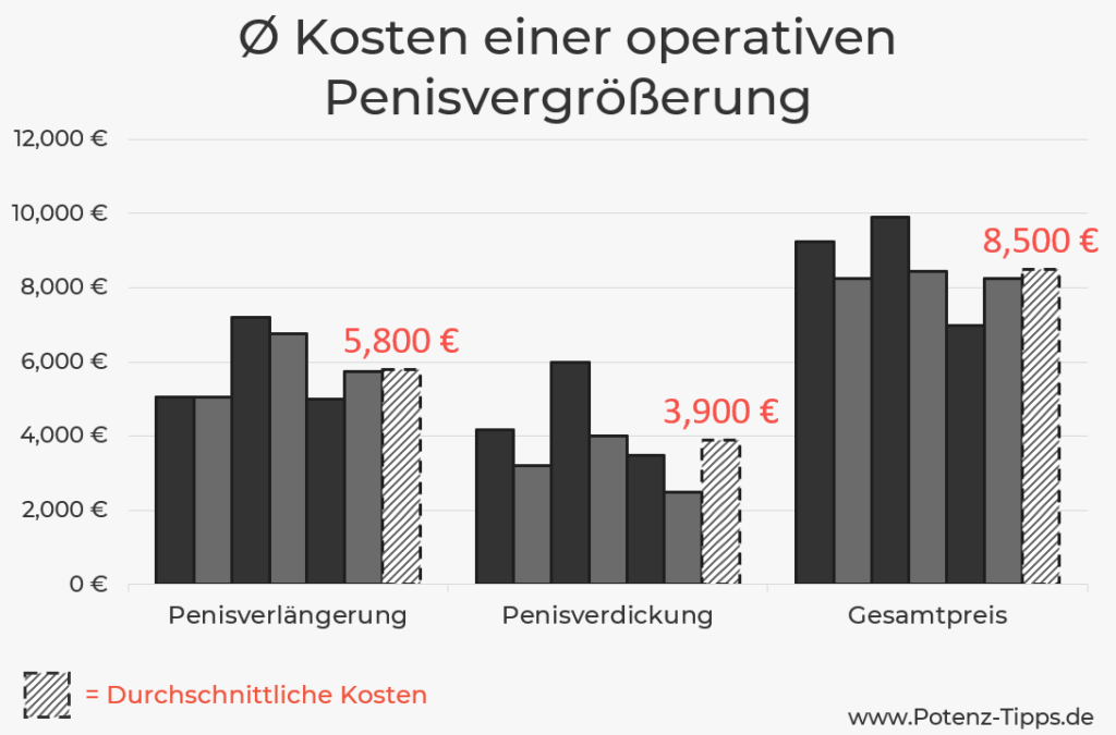 Operative Penisvergrößerung | Kosten, Ablauf, Risiken [2025] — Potenz ...