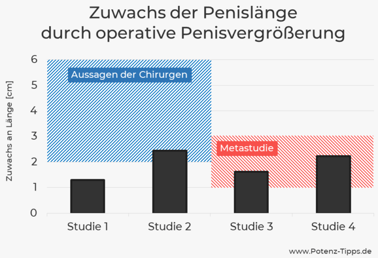 Operative Penisvergrößerung | Kosten, Ablauf, Risiken [2025] — Potenz-Tipps – Für Männer